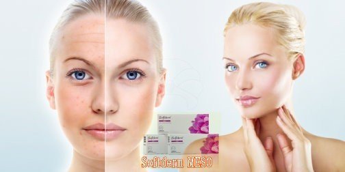 Softderm Fertigspritze, Mesolift Hydration 2ml - Dermalfillers.de ...